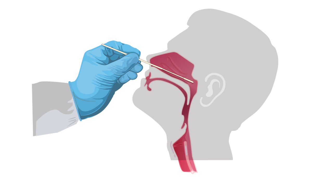 6 Simple steps for sample collection procedure for Covid-19. – Dr Lab Med